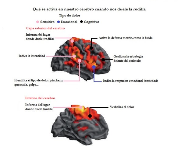 Qué sucede en nuestro cerebro cuando nos duele algo | BioAnimas